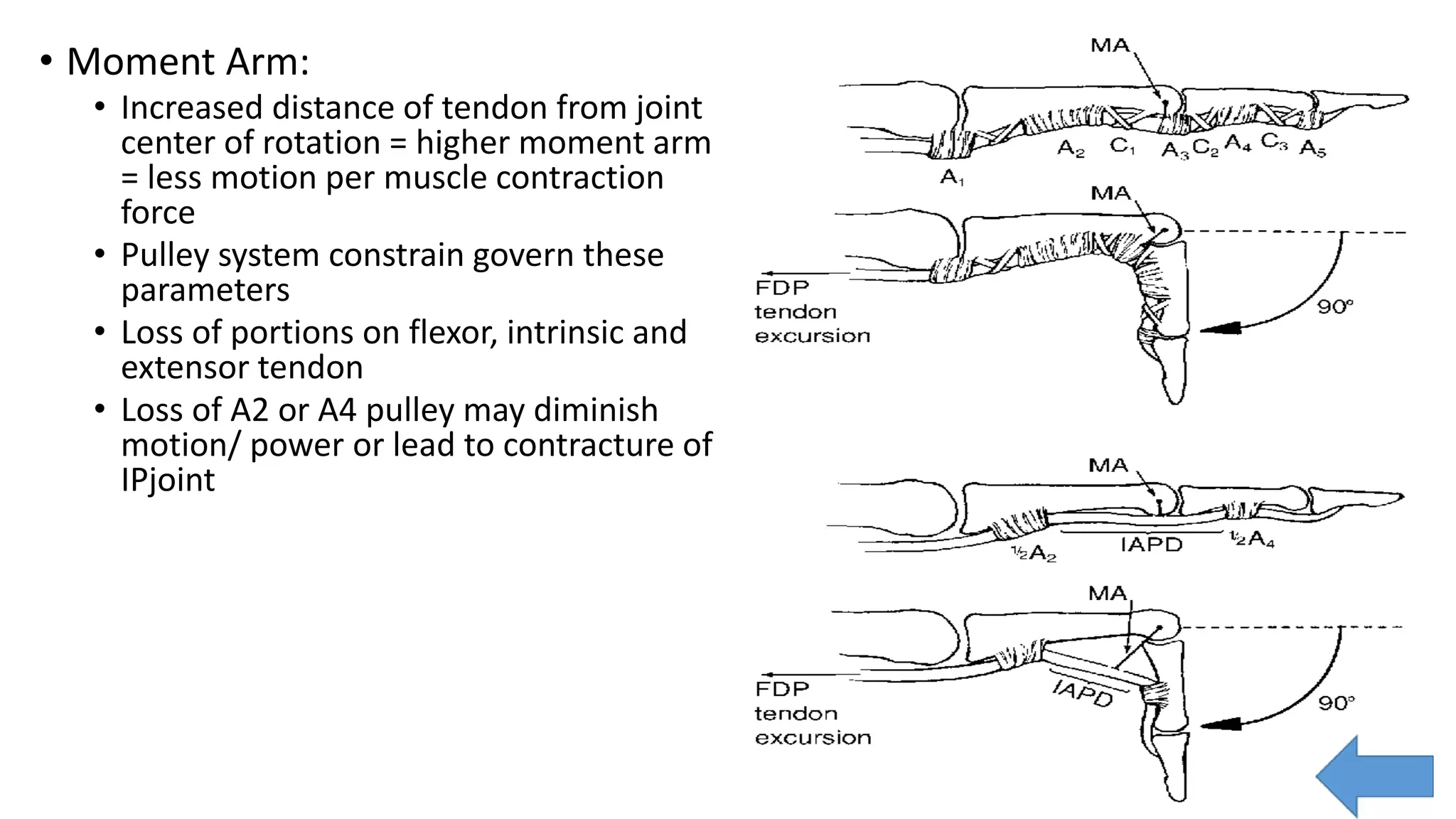 Flexor tendon injury, management and rehabilitation | PPTX