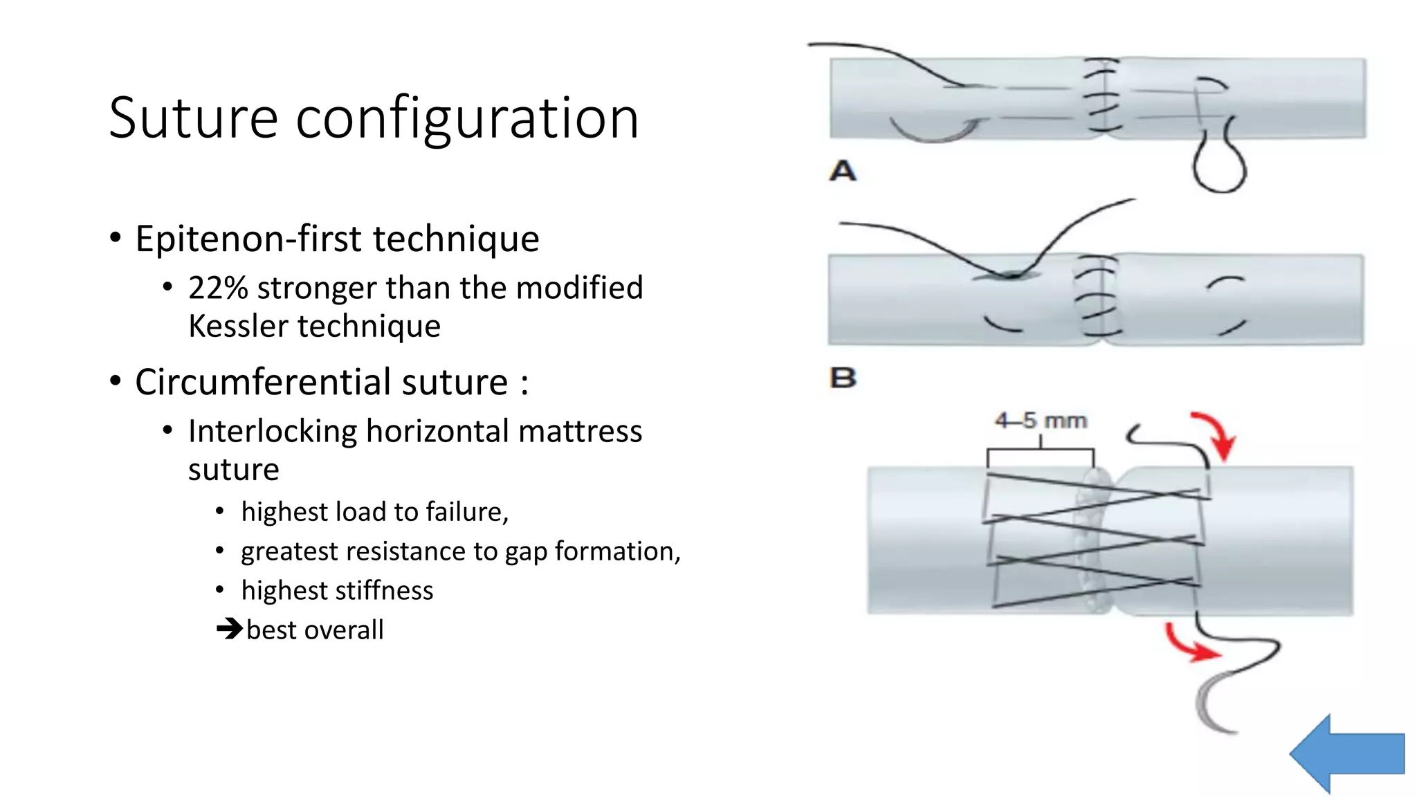 Flexor tendon injury, management and rehabilitation | PPTX