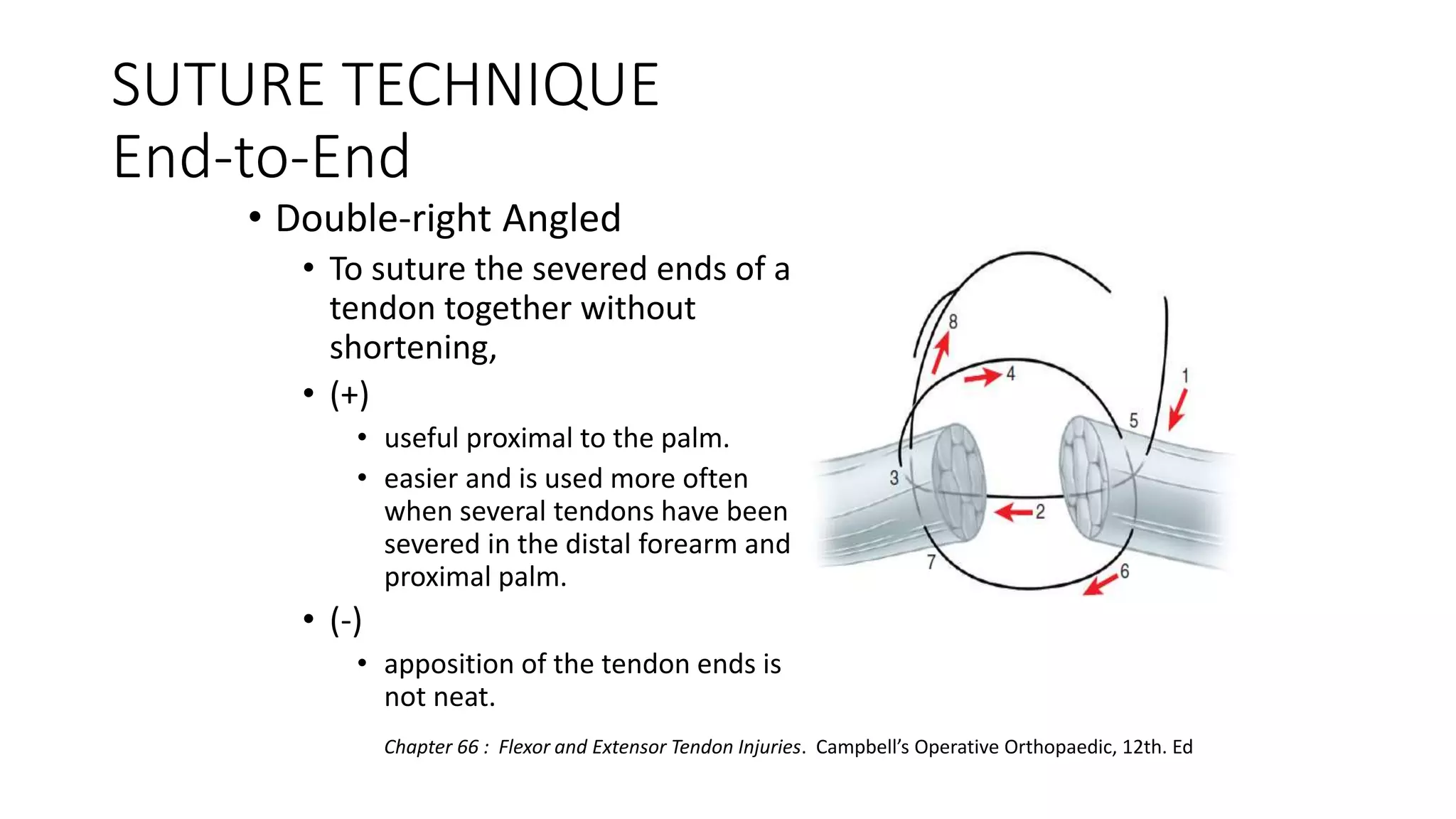 Flexor tendon injury, management and rehabilitation | PPTX