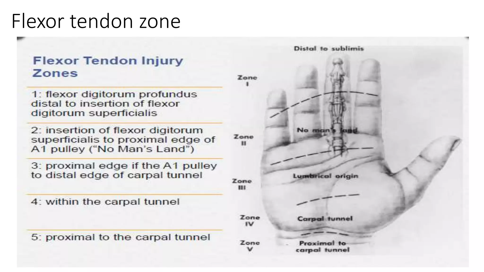 Flexor tendon injury, management and rehabilitation | PPTX | Death ...