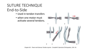 Flexor tendon injury, management and rehabilitation | PPTX