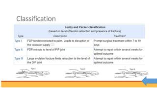 Flexor tendon injury, management and rehabilitation | PPTX
