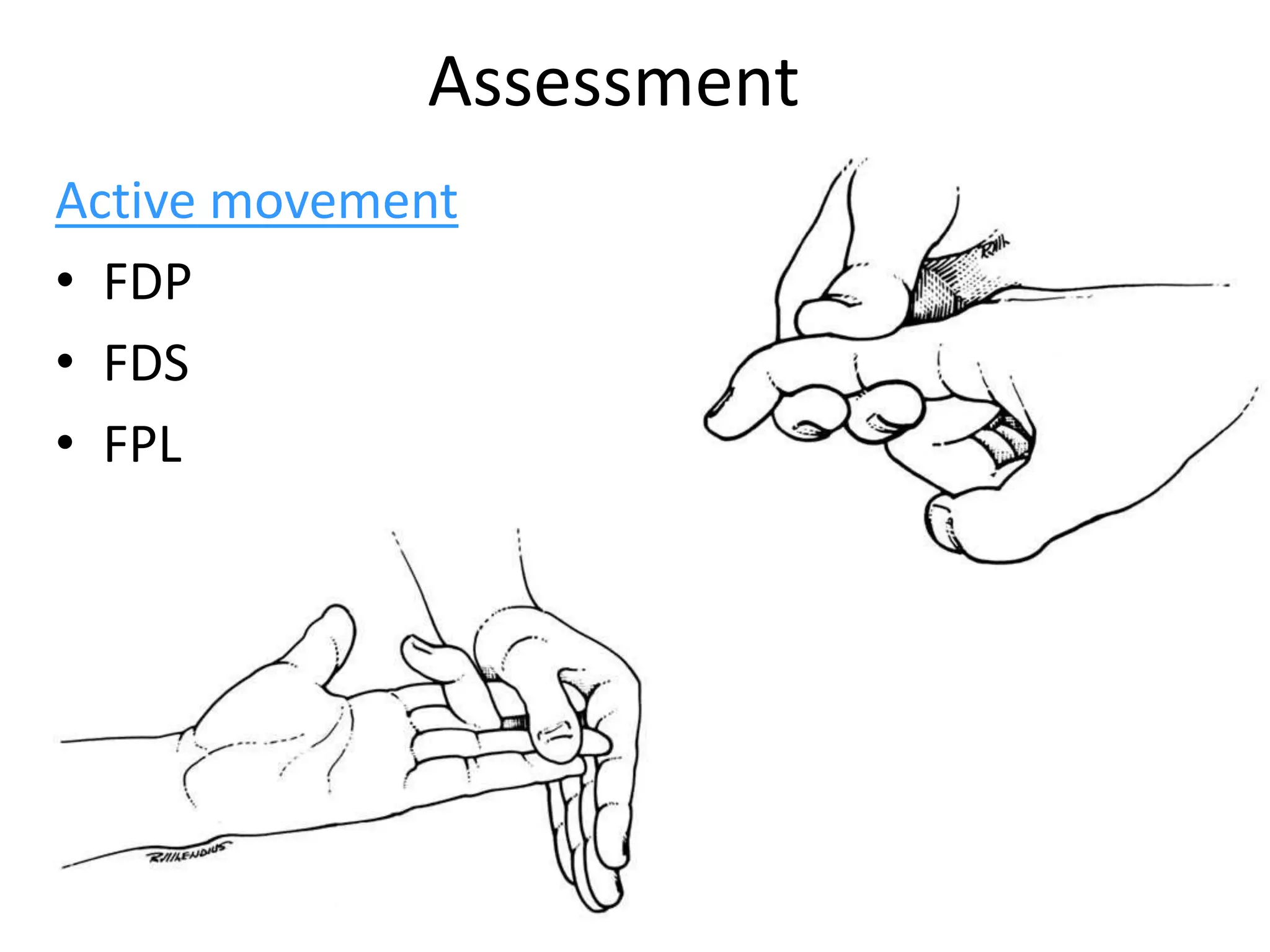 Flexor tendon surgery Review | PPTX