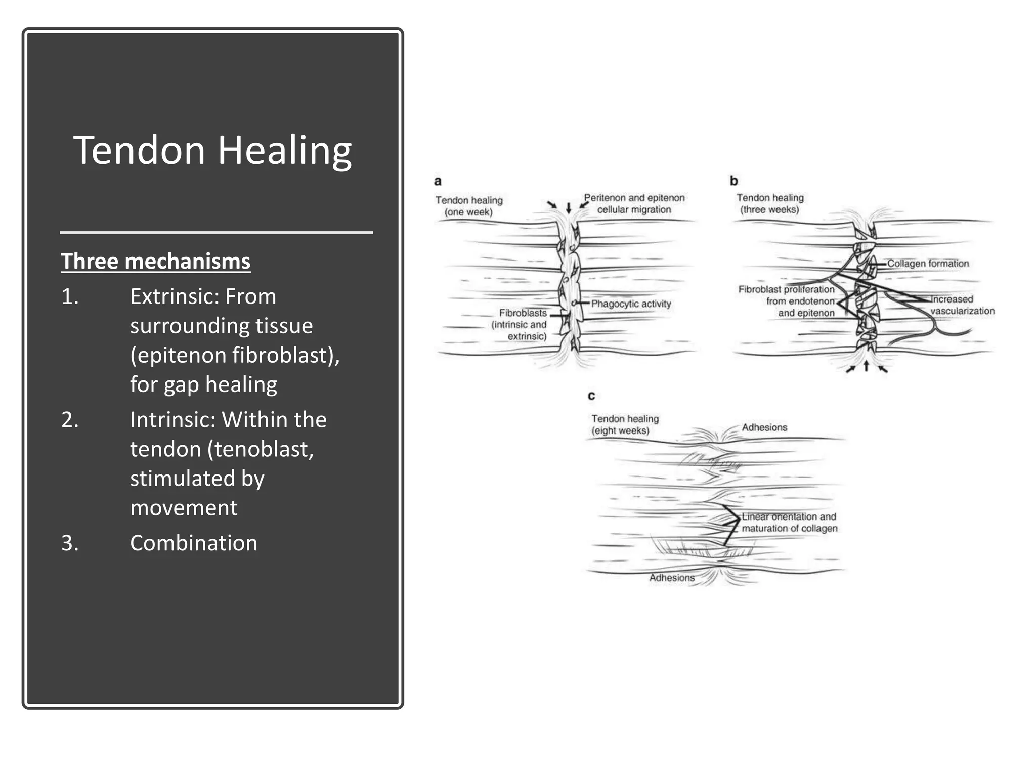 Flexor tendon surgery Review | PPTX