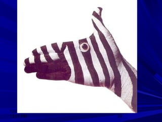 Flexor tenolysis | PPT