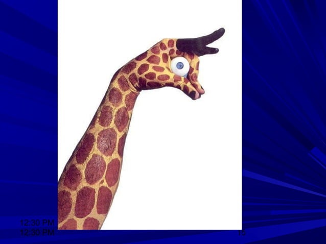 Flexor tenolysis by Dr Ga | PPT