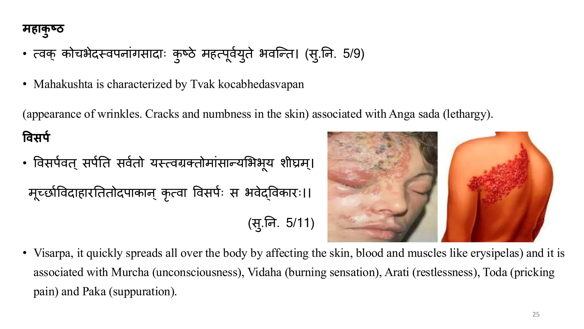 Importance of Shodana in Kushta chikitsa-An ayurvedic view | PDF