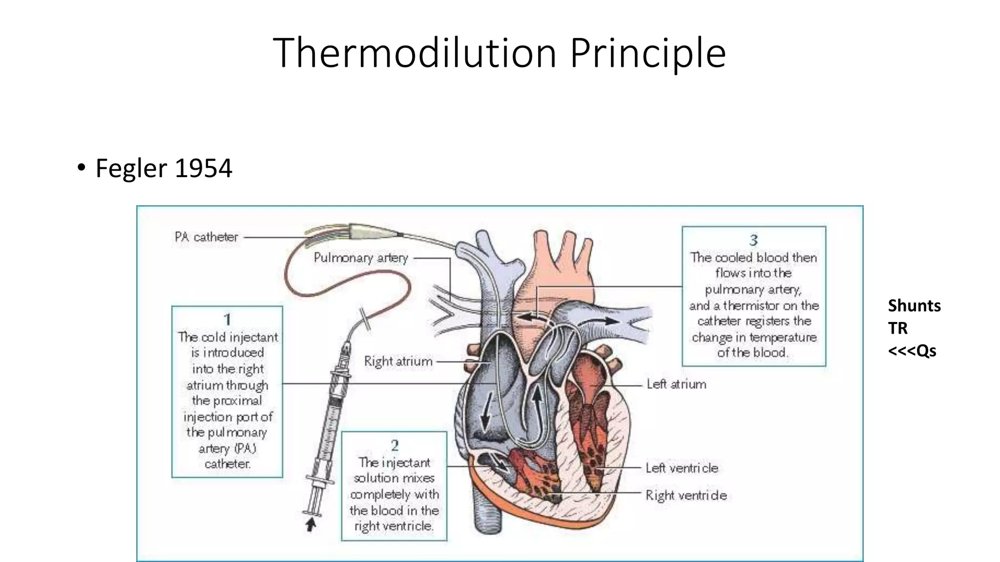 Flick and thermodilution principles | PPTX