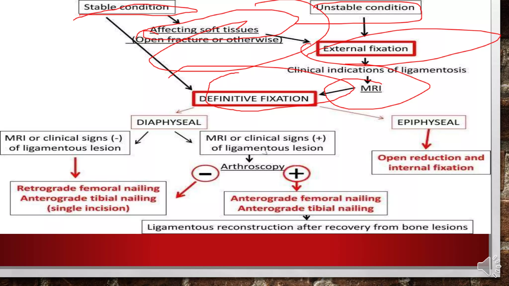 Floating knee | PPTX