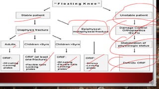 Floating knee | PPTX