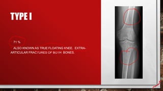 Floating knee | PPTX