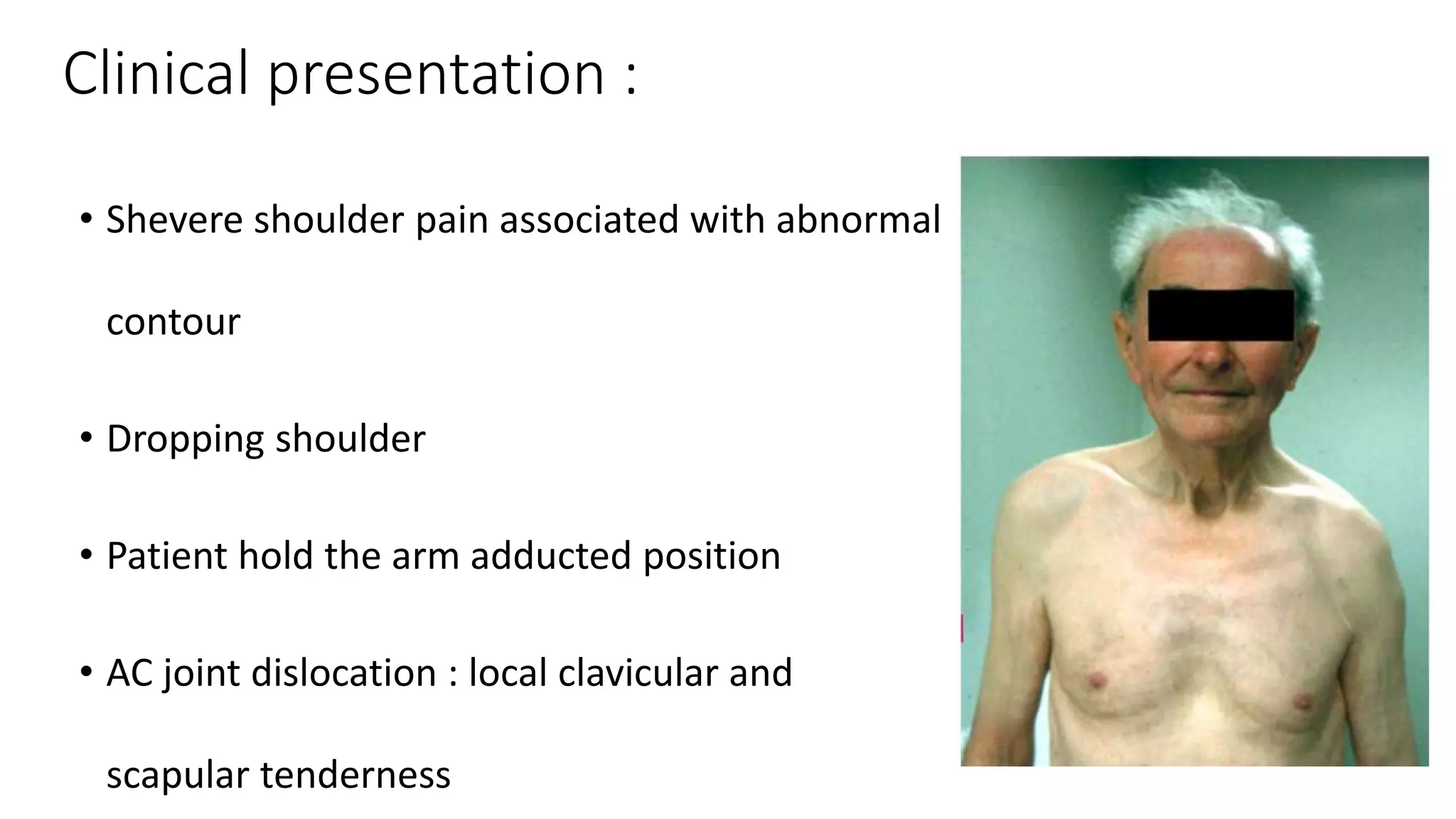 floating shoulder ppt-3.pptx Dr Ashish pargaie Orthopaedic resident ...