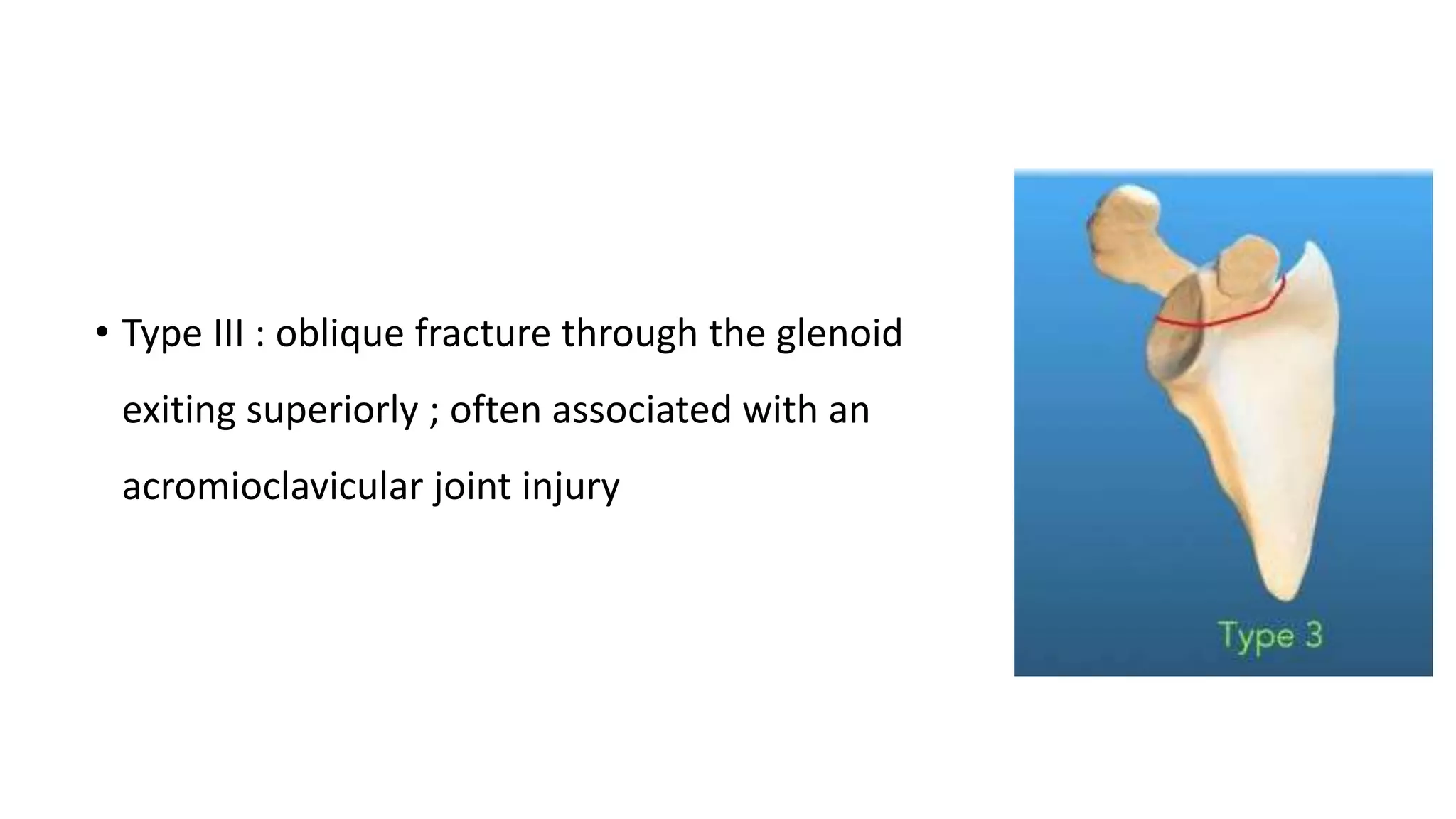 floating shoulder ppt-3.pptx Dr Ashish pargaie Orthopaedic resident ...