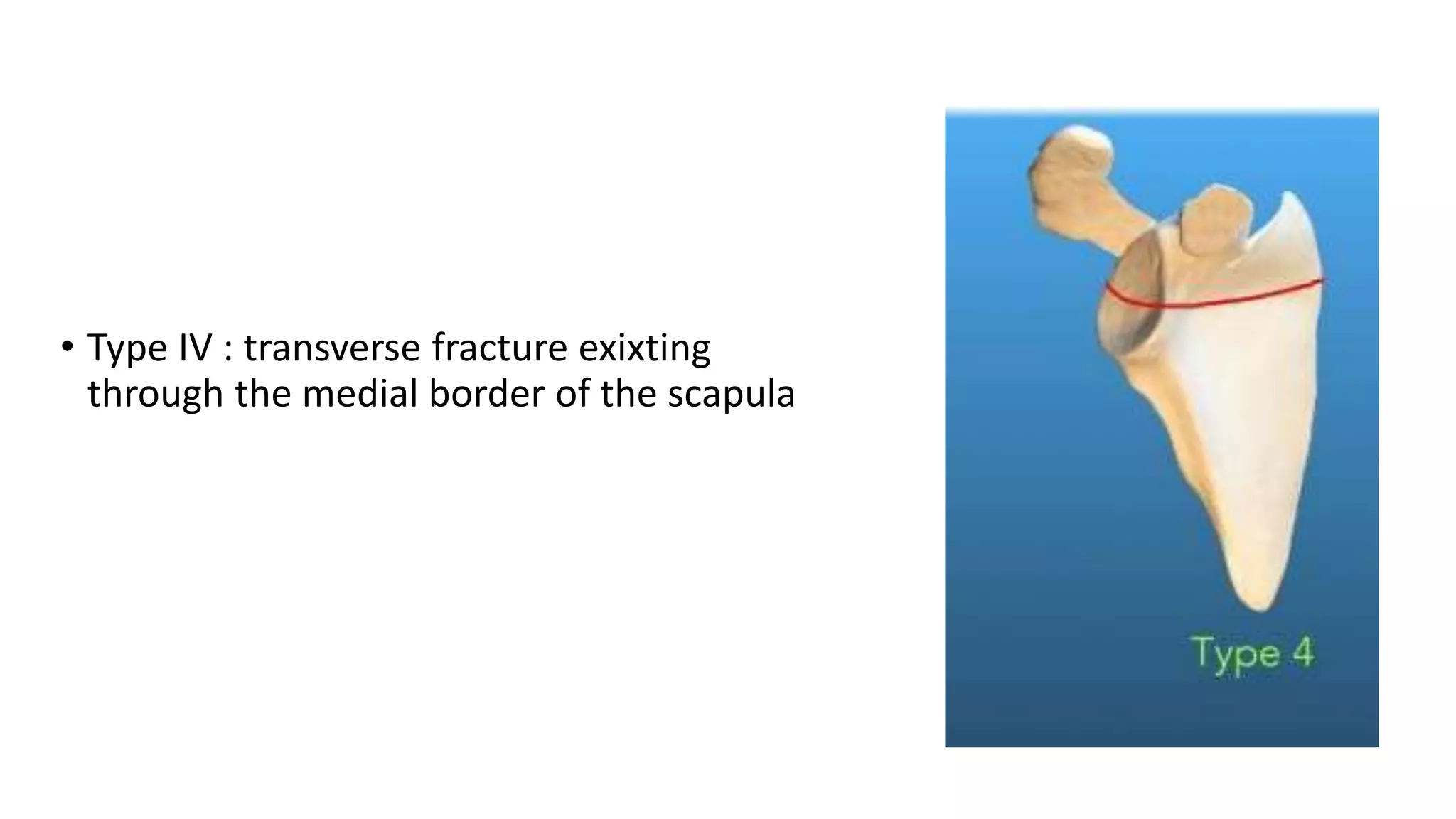 floating shoulder ppt-3.pptx Dr Ashish pargaie Orthopaedic resident ...