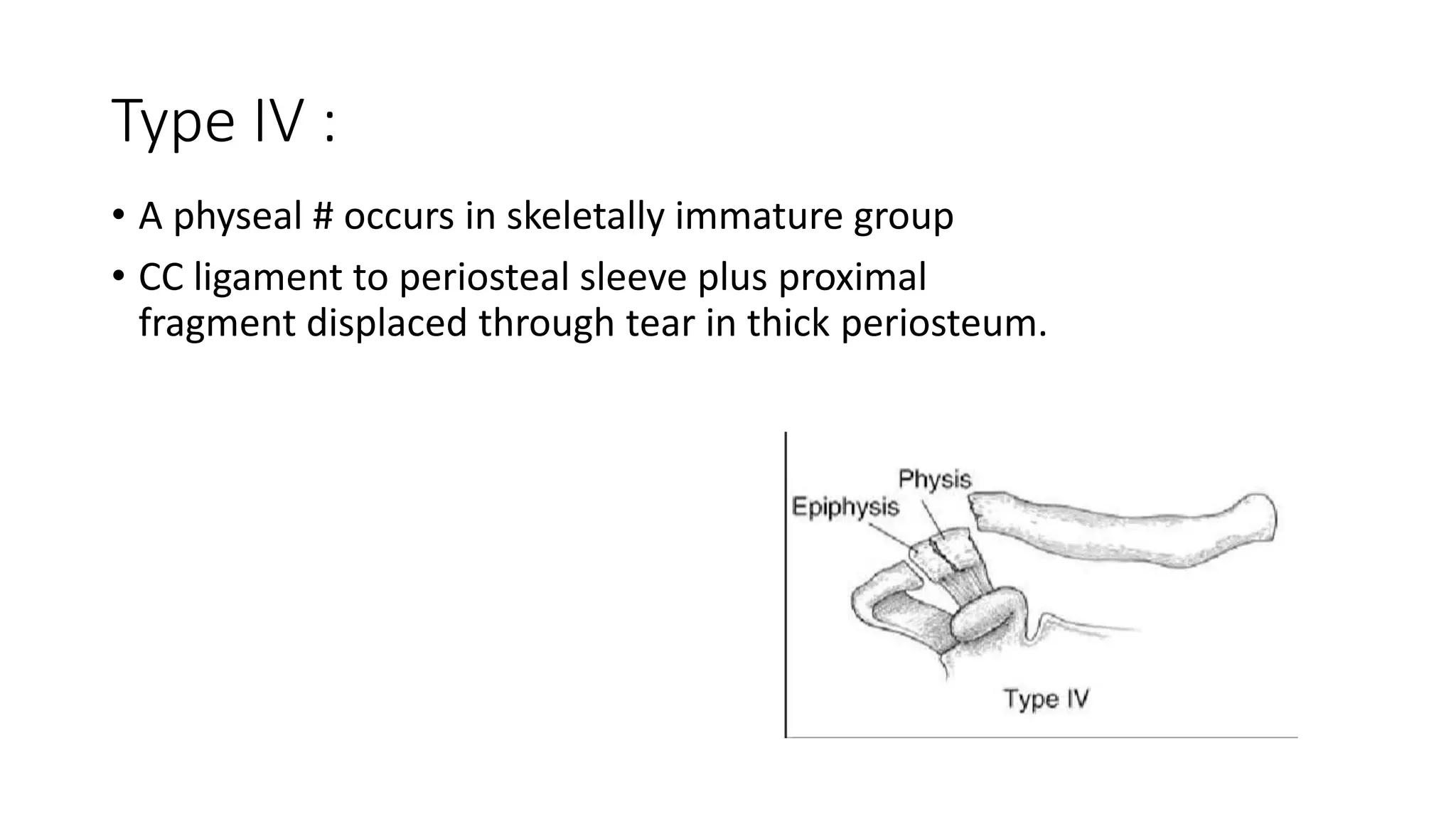 floating shoulder ppt-3.pptx Dr Ashish pargaie Orthopaedic resident ...
