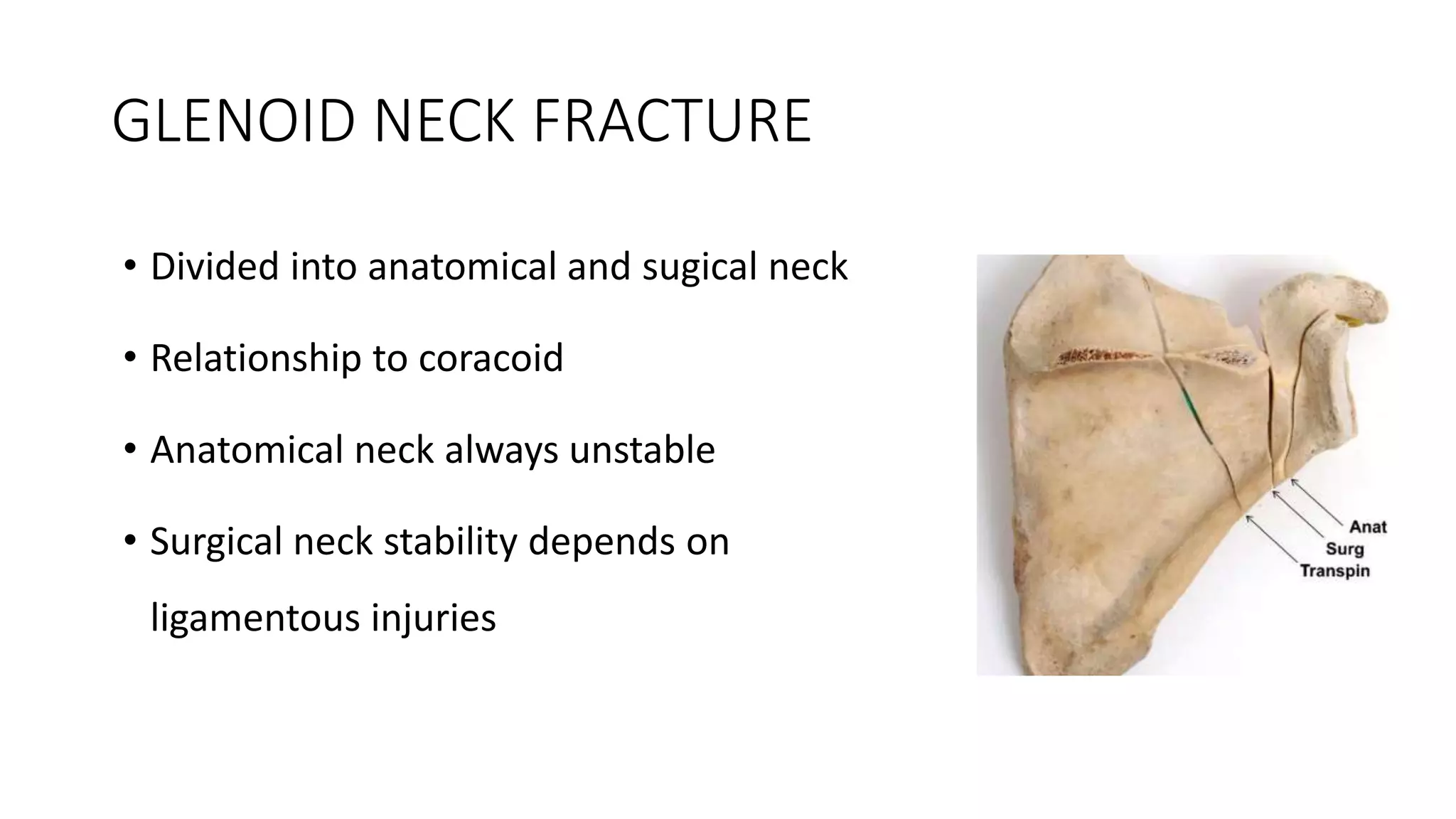 floating shoulder ppt-3.pptx Dr Ashish pargaie Orthopaedic resident ...