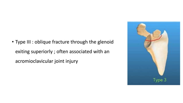 floating shoulder ppt-3.pptx Dr Ashish pargaie Orthopaedic resident ...
