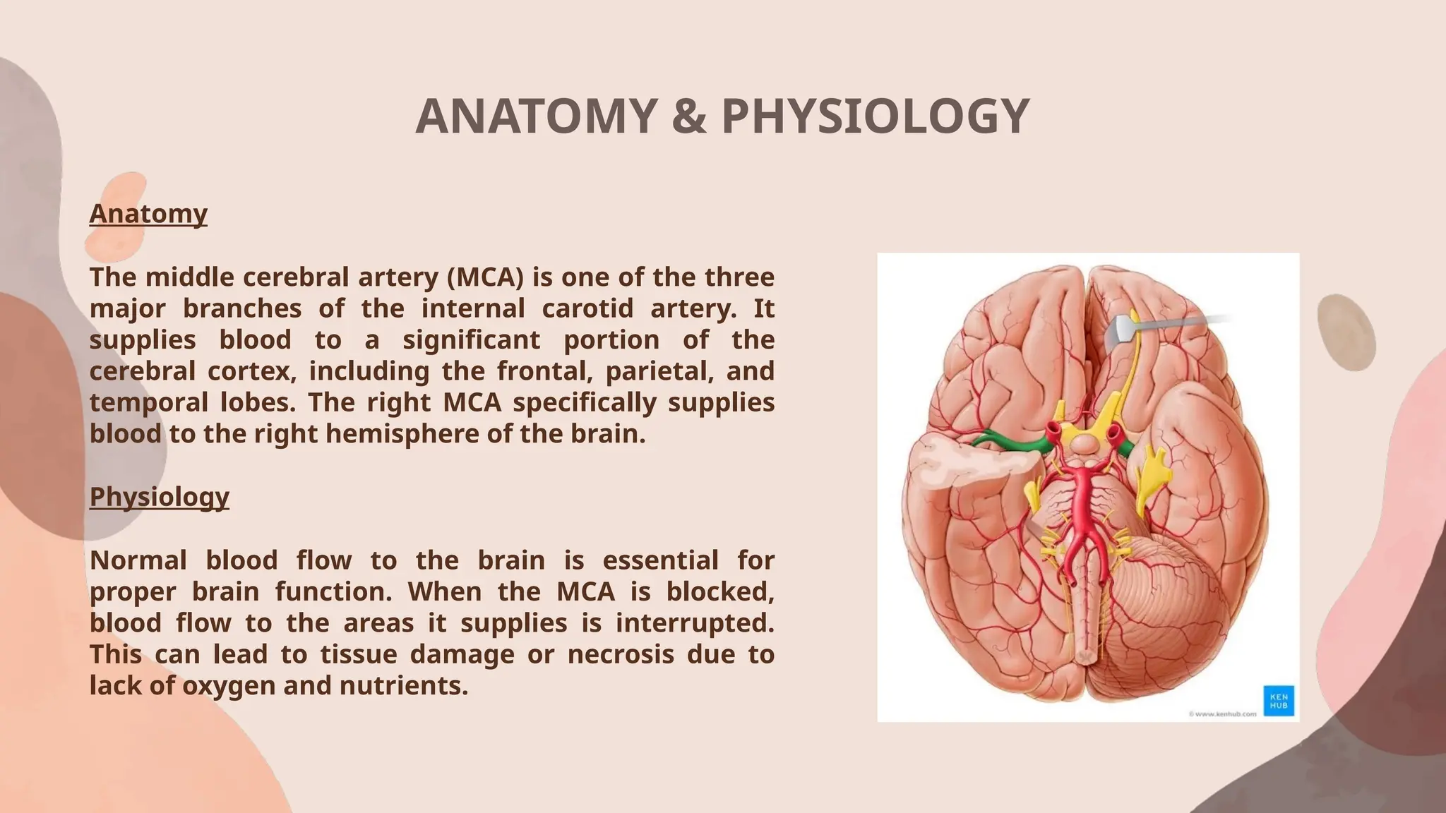 A case study of Right Middle Cerebral Artery Infarction | PPT