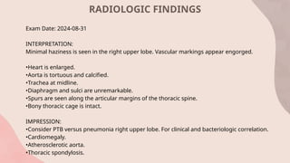 A case study of Right Middle Cerebral Artery Infarction | PPTX