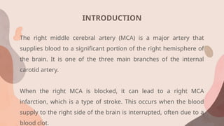 A case study of Right Middle Cerebral Artery Infarction | PPT