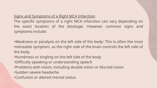 A case study of Right Middle Cerebral Artery Infarction | PPT