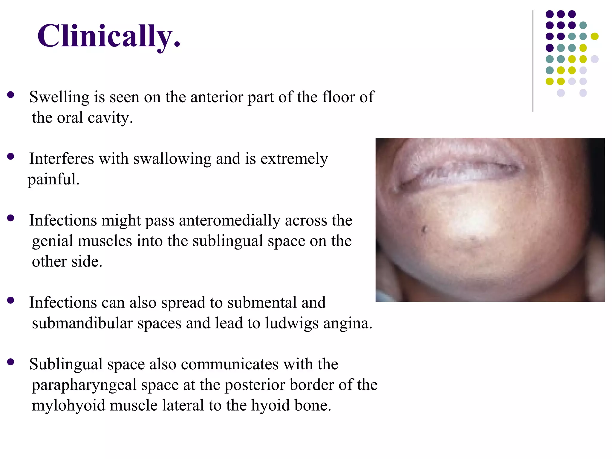 Floor of the mouth | PPT