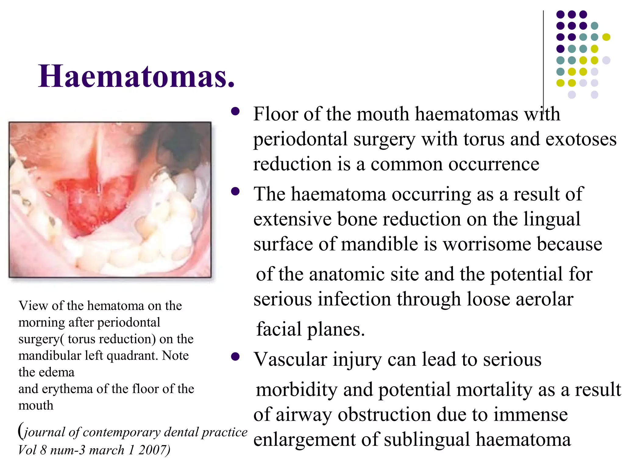 Floor of the mouth | PPT
