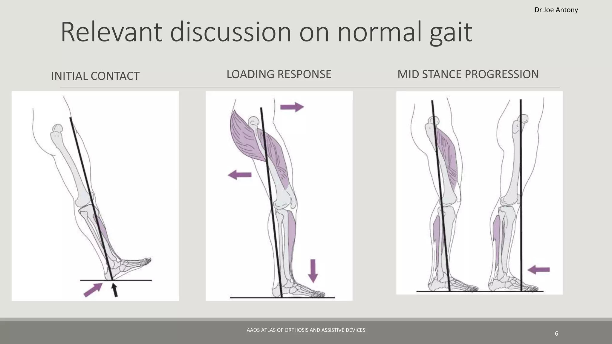 Floor reaction Ankle foot orthosis or Gravity reaction ankle foot ...