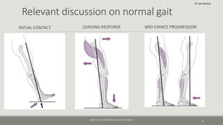 Floor reaction Ankle foot orthosis or Gravity reaction ankle foot ...