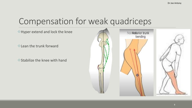 Floor reaction Ankle foot orthosis or Gravity reaction ankle foot ...