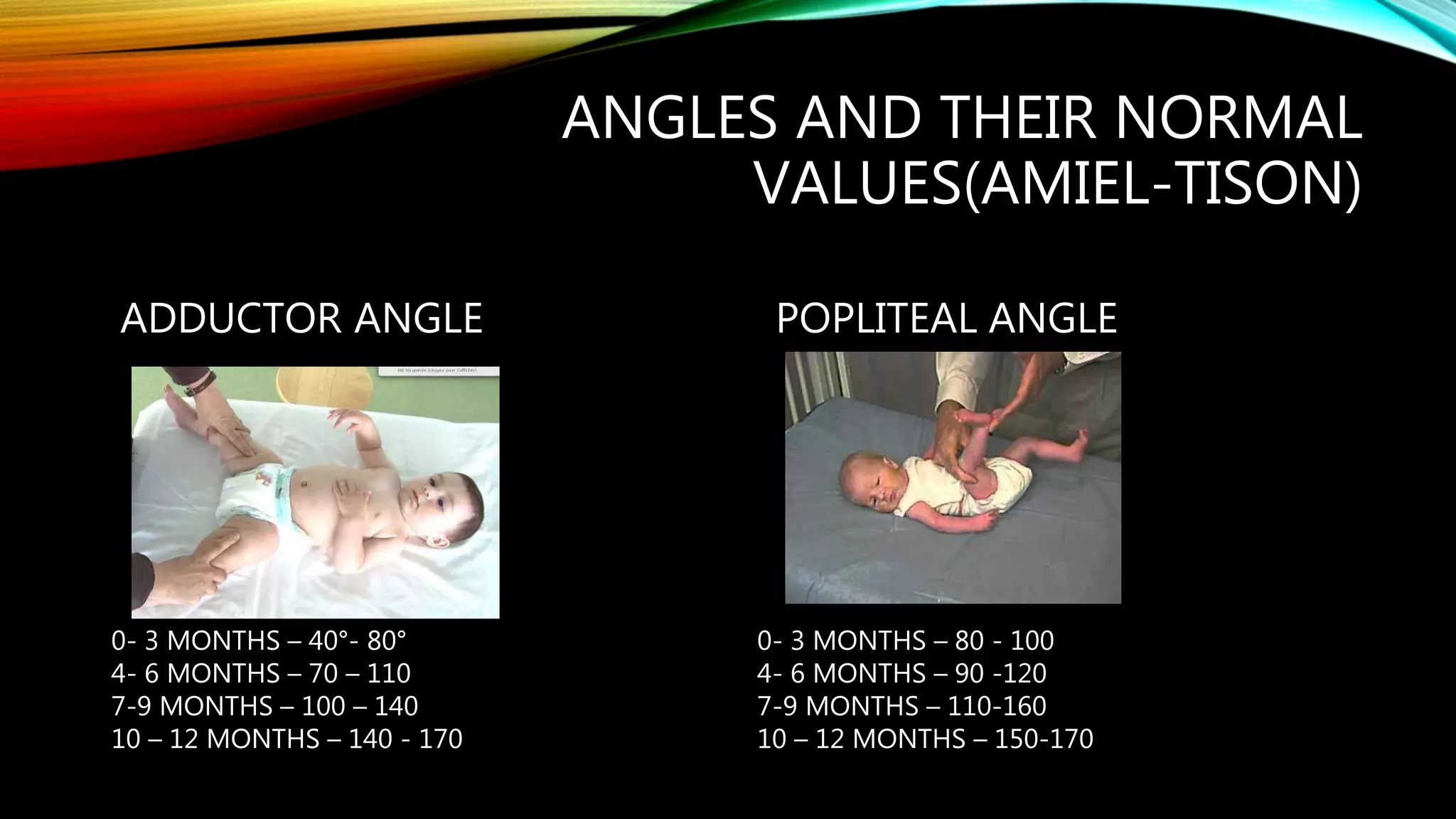 approach to a floppy infant | PPTX