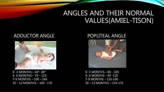 approach to a floppy infant