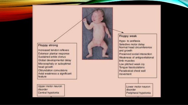 approach to a floppy infant