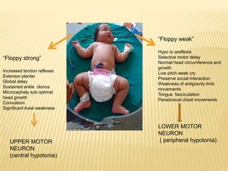 Approach to a child with hypotonia.pptx