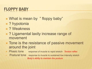 Approach to a child with hypotonia.pptx
