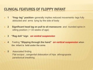 Approach to a child with hypotonia.pptx