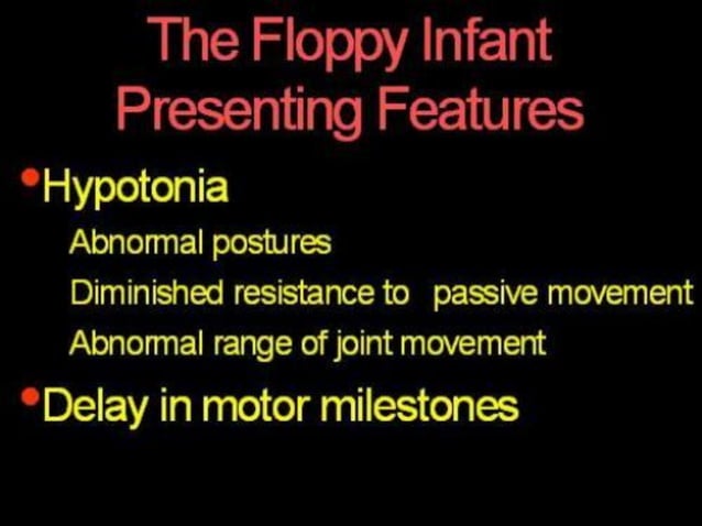 Floppy infant | PDF | Pregnancy | Reproductive Health