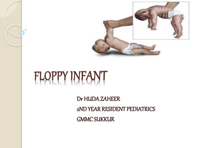 floppy infant.pptx | Pregnancy | Reproductive Health