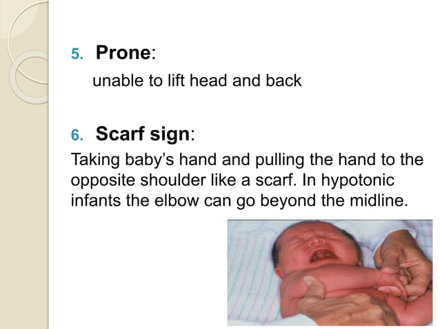 floppy infant.pptx | Pregnancy | Reproductive Health