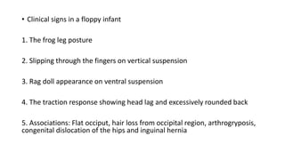 Floppy infant karan gagneja | PPTX