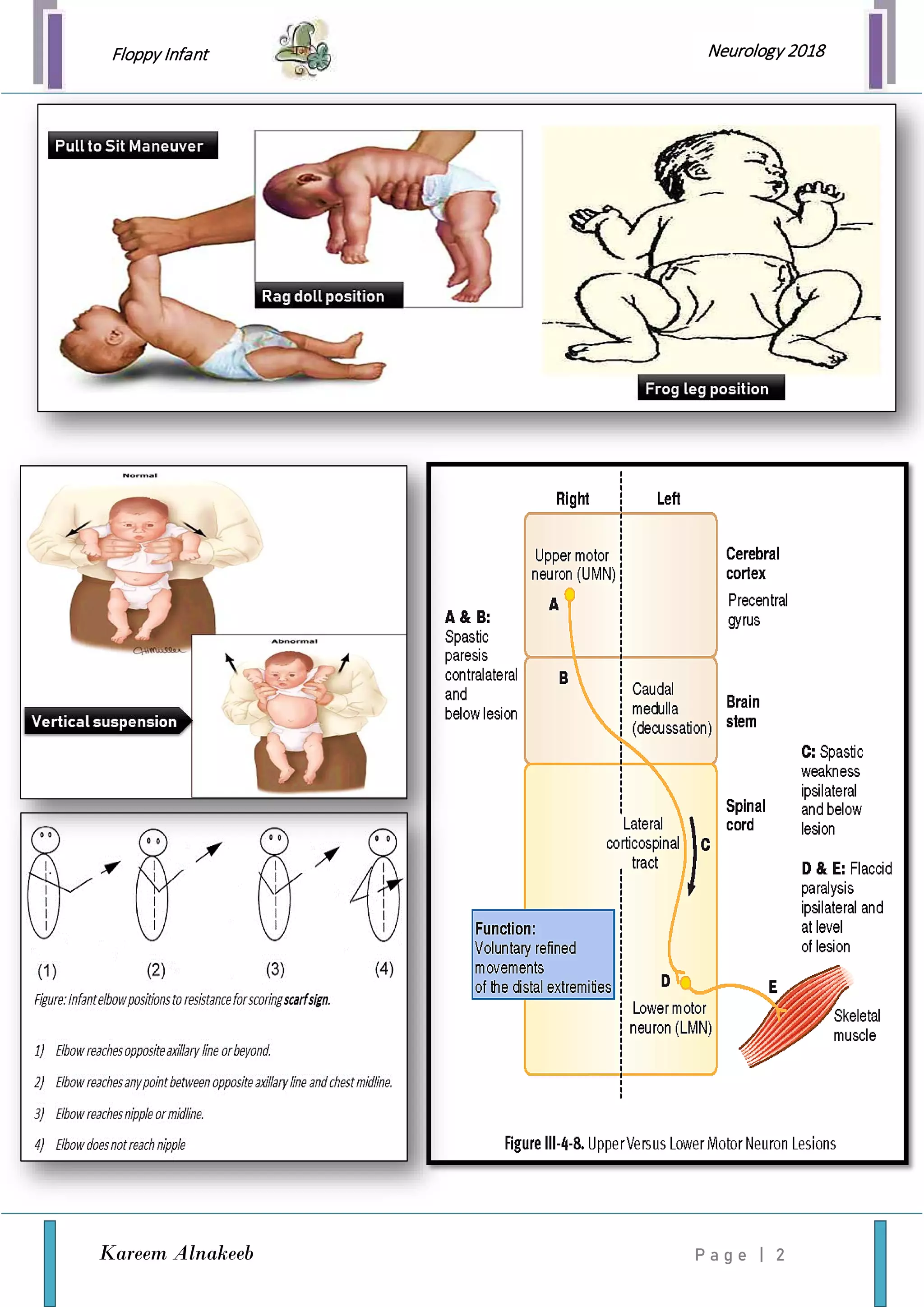 Floppy infant; Pediatrics 2018 | PDF
