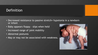 FLOPPY INFANTneuropedicon 2017.pptx