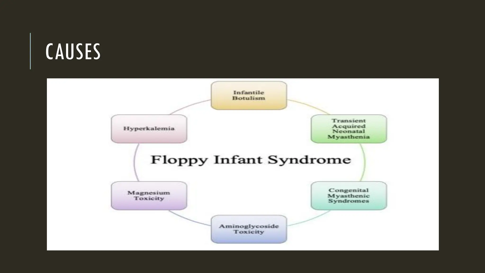 FLOPPY INFANT SYNDROM,CHENNELOPATHY, CRAMP.pdf