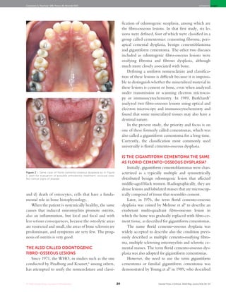 Florid cemento osseous dysplasia a contraind to ortho tx in compromised ...