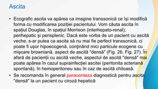 Florin Blagniceanu.pptx