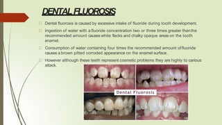 Flouride in dentistry | PPTX