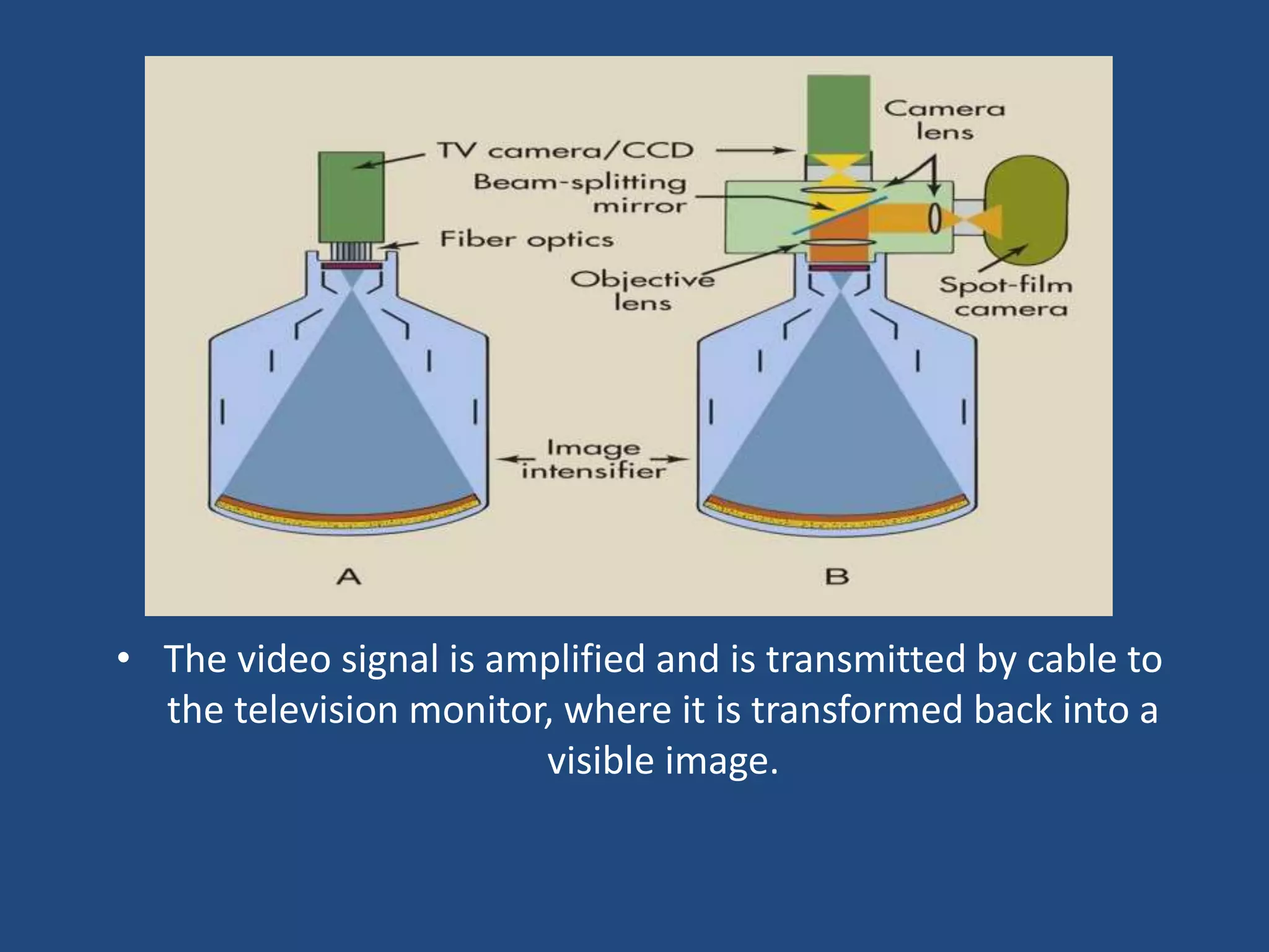 Flouroscopic procedures | PPTX