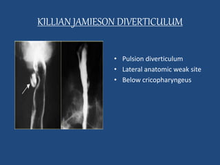 Flouroscopic procedures | PPTX