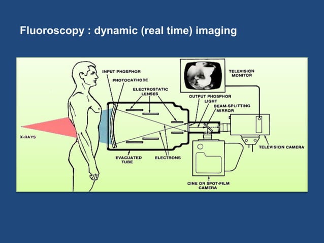 Flouroscopic procedures | PPTX