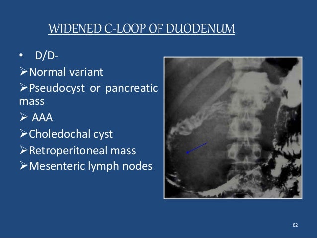 Double Contrast Barium Enema Preparation Diet - clipinter